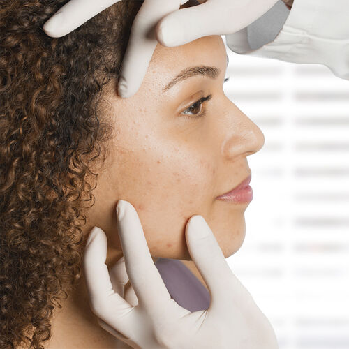 How to Get Clearer Skin